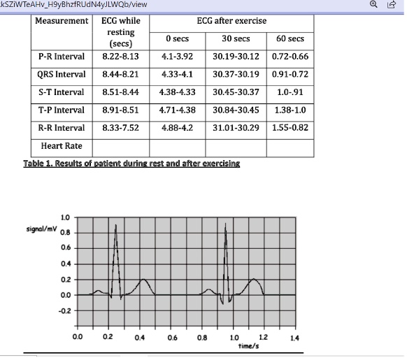 Measurement ECG while ECG after exercise resting 0 secs 30 secs 60 secs ...