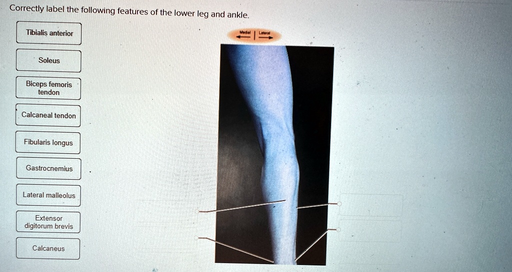 correctly label the following features of the lower leg and ankle ...