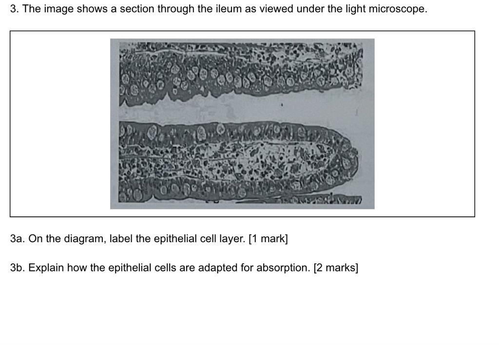 3 the image shows a section through the ileum as viewed under the light ...