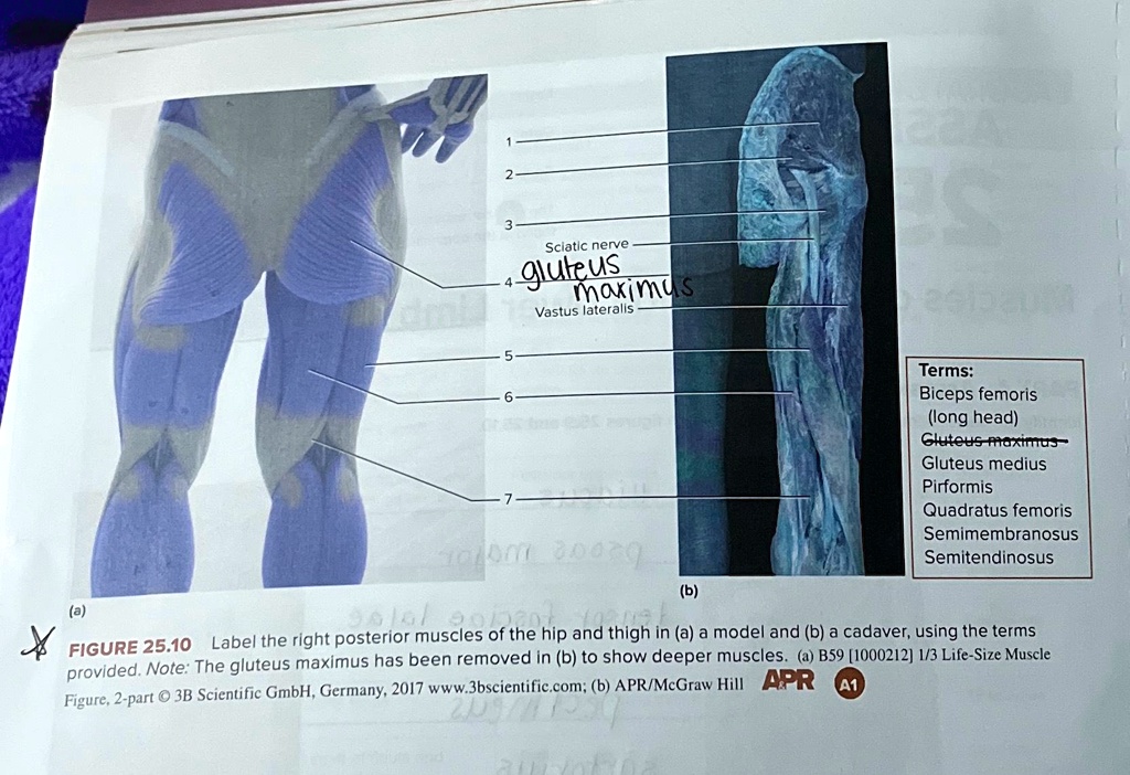 SOLVED: π || Sciatic nerve, gluteus maximus, vastus lateralis Terms ...