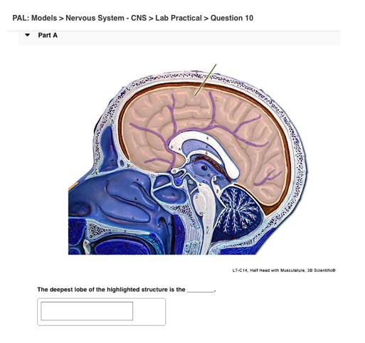 SOLVED: PAL: Models > Nervous System -CNS> Lab Practical> Question 10 ... SOLVED: PAL: Models > Nervous System -CNS> Lab Practical> Question 10 ...