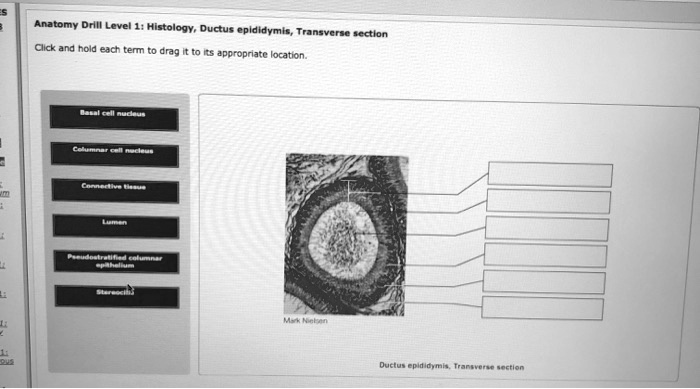 Anatomy Drill Level 1: Histology, Ductus epididymis, Transverse section ...