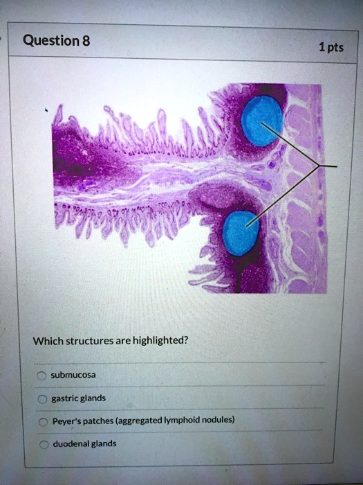 Which structures are highlighted? - submucosa - gastric glands - Peyer ...