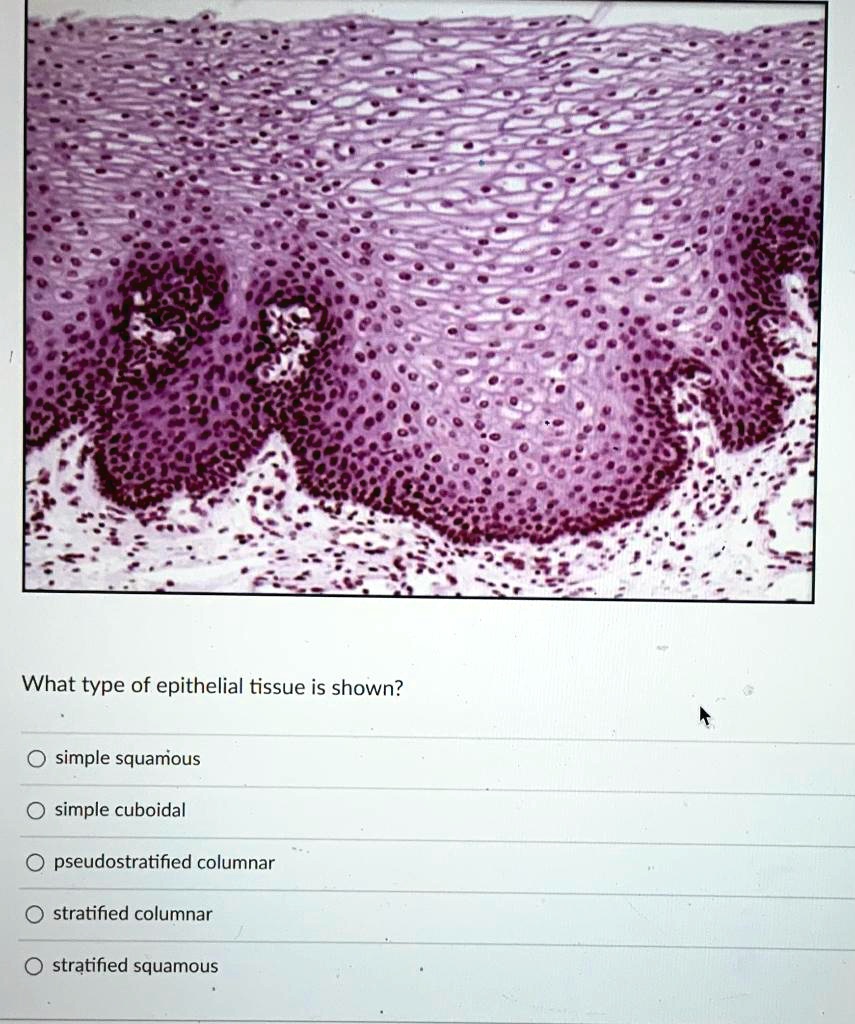 SOLVED: What type of epithelial tissue is shown? A. Simple squamous B ...
