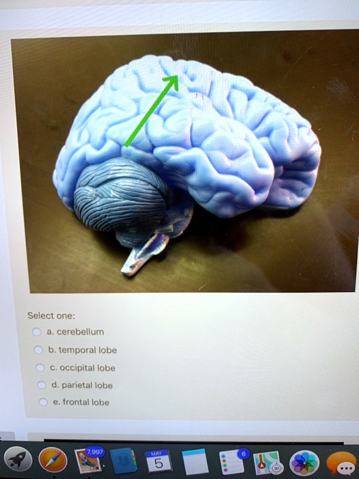 SOLVED: Select one: cerebellum temporal lobe occipital lobe parietal lobe frontal lobe