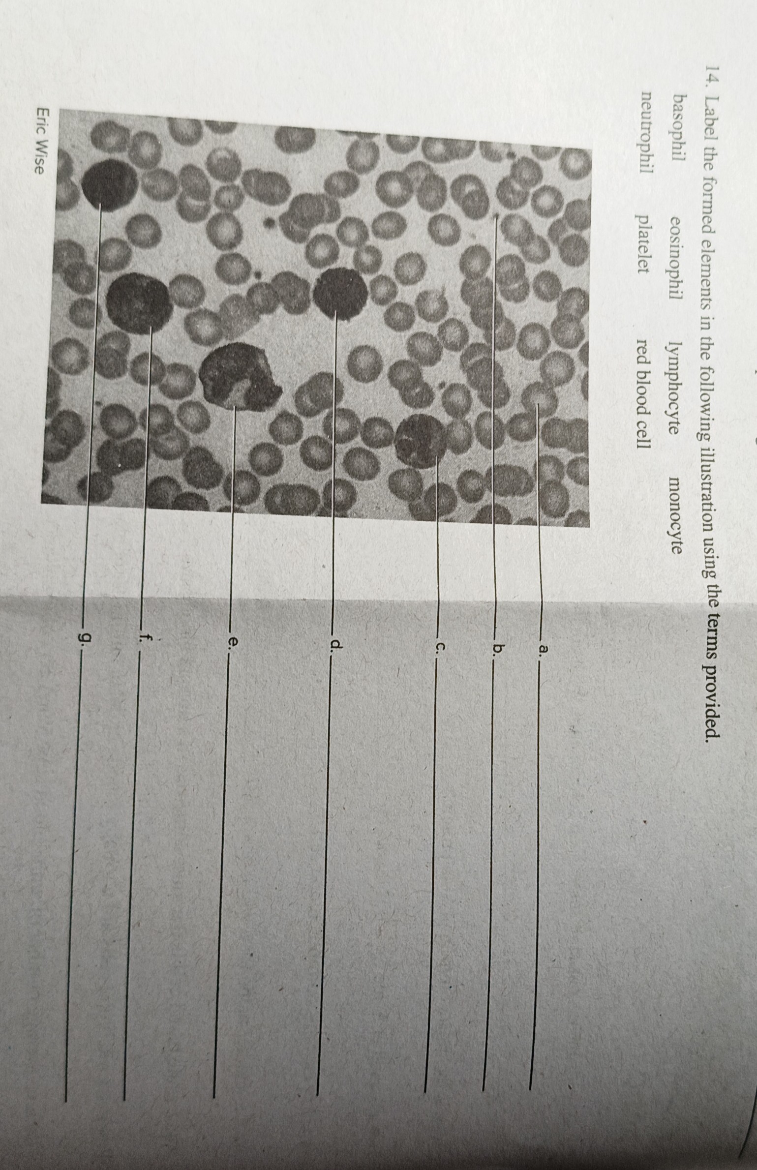 SOLVED: 14. Label the formed elements in the following illustration ...