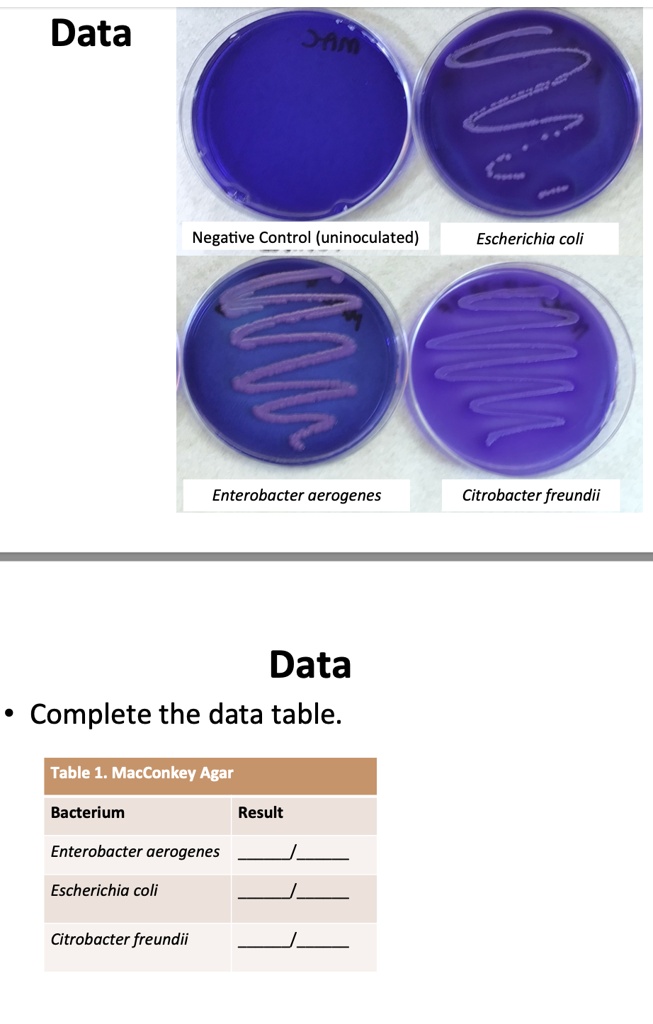 SOLVED: Data Negative Control (uninoculated) Escherichia coli ...