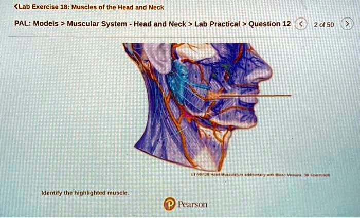 SOLVED: Lab Exercise 18: Muscles of the Head and Neck PAL Models ... SOLVED: Lab Exercise 18: Muscles of the Head and Neck PAL Models ...