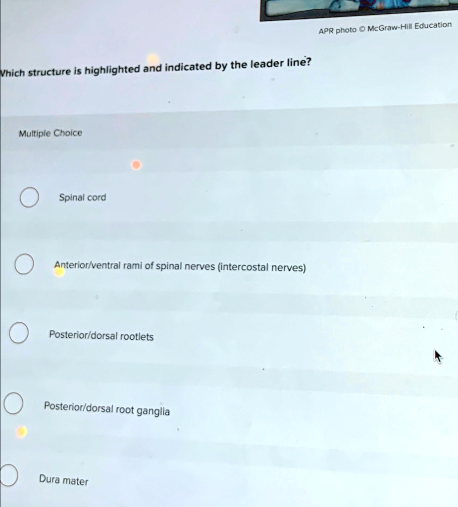 which structure is highlighted and indicated by the leader line ...