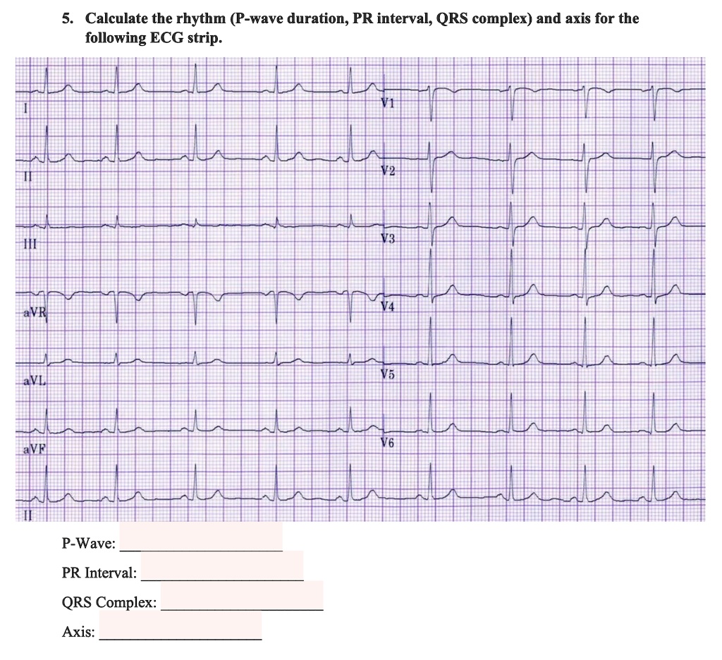 SOLVED: Calculate the rhythm (P-wave duration, PR interval, QRS complex) and axis for the ...