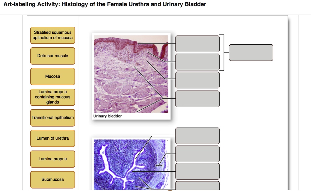 SOLVED: Art-labeling Activity: Histology of the Female Urethra and ...
