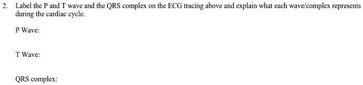2. Label the P and T wave and the QRS complex on the ECG tracing above ...