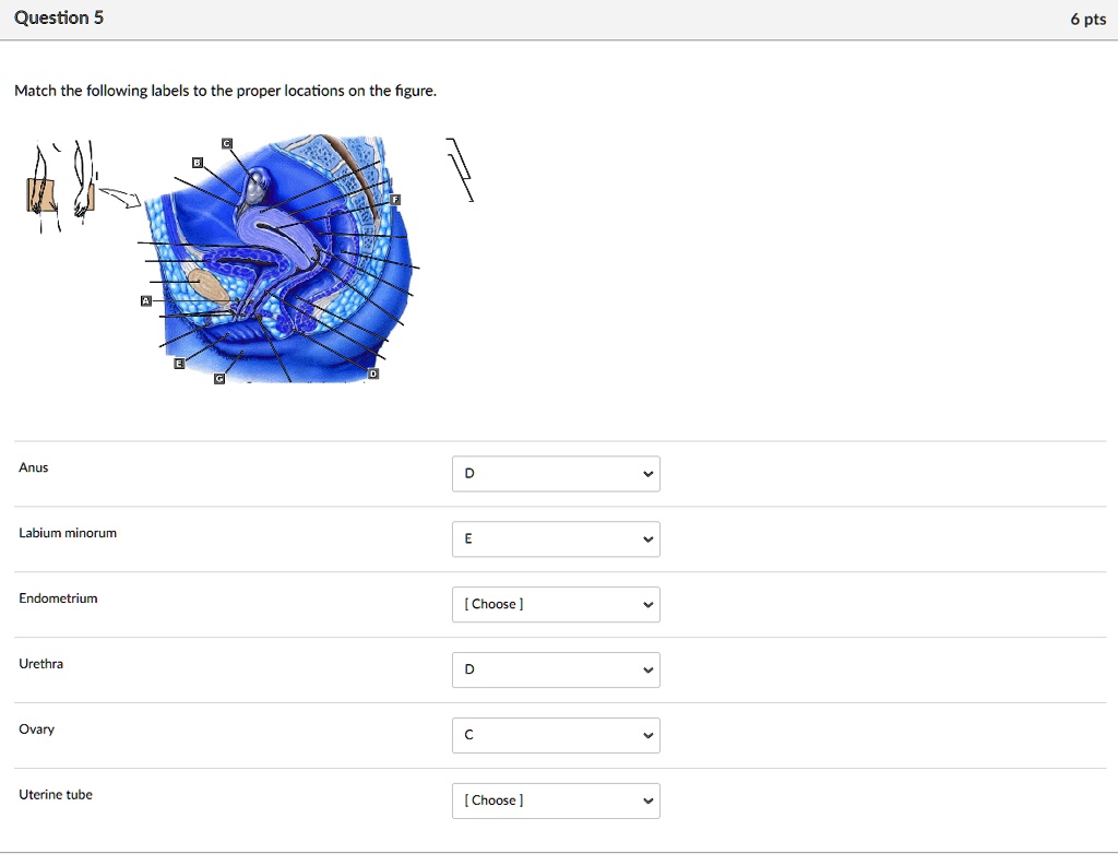 Question 5 6 pts Match the following labels to the proper locations on ...