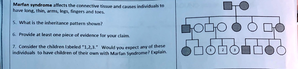 marfan syndrome affects the connective tissue and causes individuals to ...