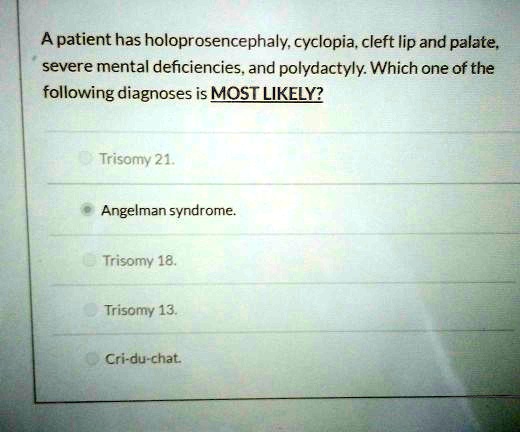A patient has holoprosencephaly cyclopia cleft lip and...