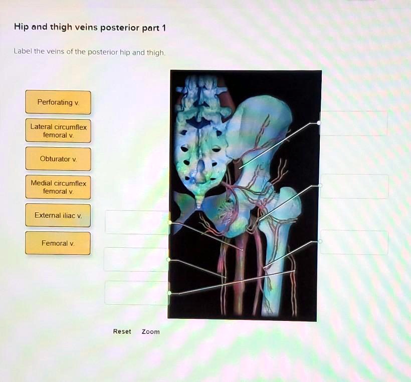 Hip and thigh veins posterior part 1 Label the veins of the posterior ...