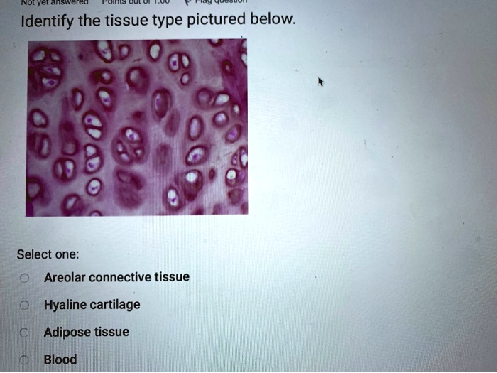 nolyel answeted identify the tissue type pictured below select one ... nolyel answeted identify the tissue type pictured below select one ...