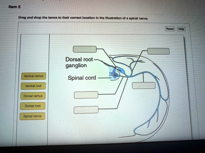 SOLVED: Drag and drop the terms to their correct location in the ...
