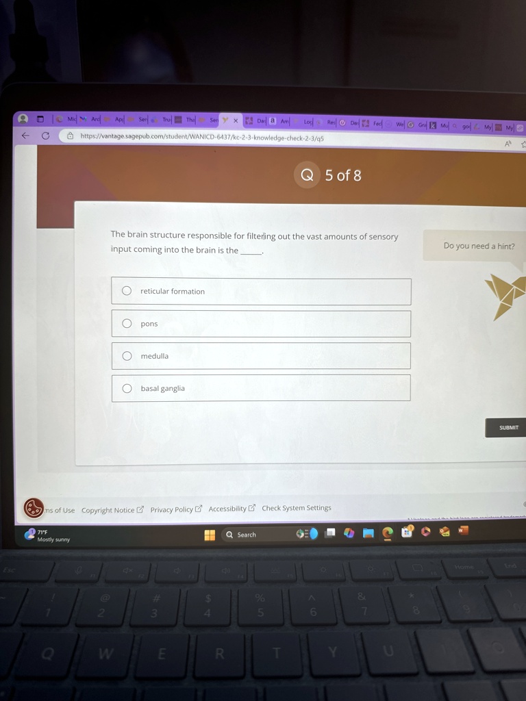 the brain structure responsible for filtering out the vast amounts of ...