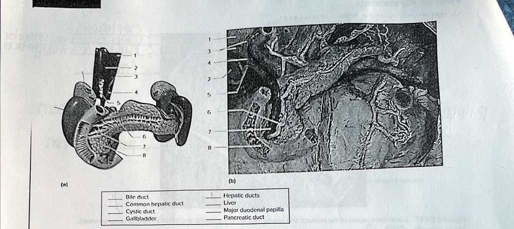 8 (a) Bile duct Common hepatic duct Cystic duct Gallbladder (b) Hepatic ...