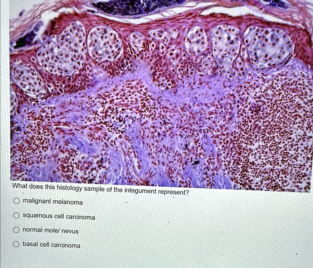 [GET ANSWER] What does this histology sample of the integument ...