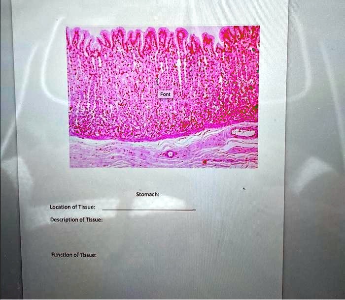 SOLVED: Texts: Font Stomach: Location of Tissue: Description of Tissue ...