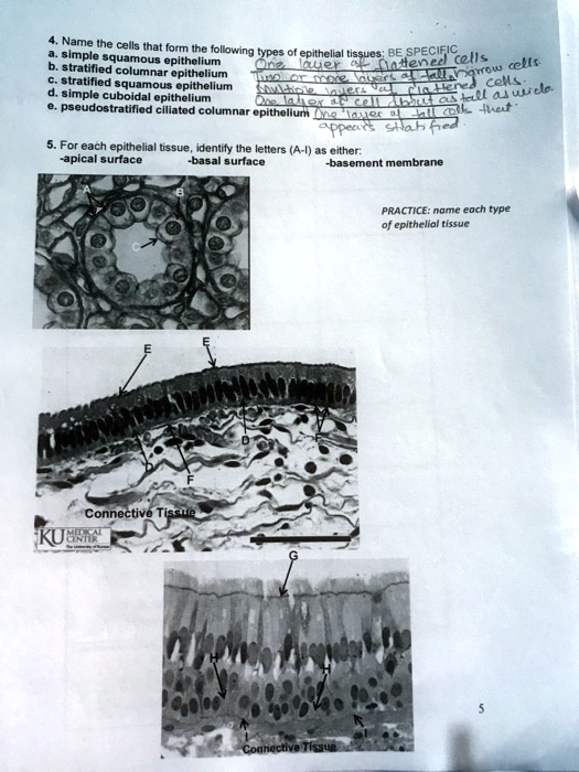 a. Simple squamous epithelium b. Stratified columnar epithelium c ...