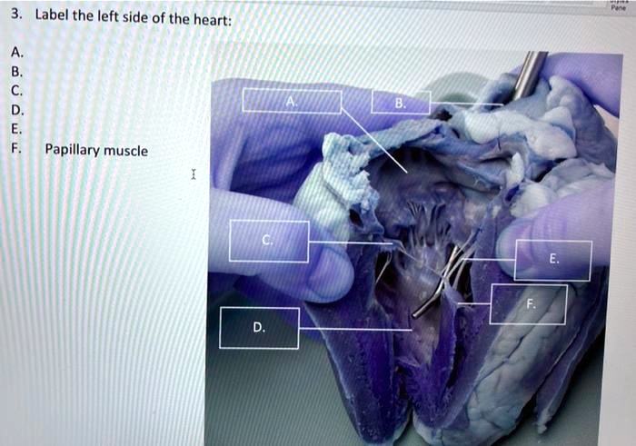 SOLVED: Label the left side of the heart: 8, Papillary muscle
