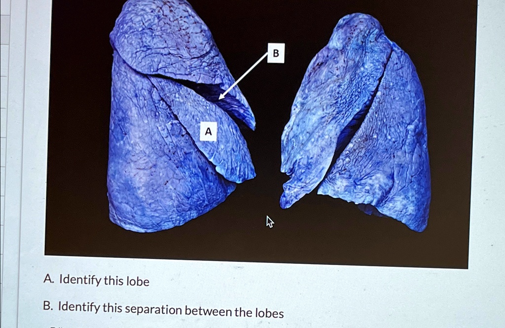 a identify this lobe b identify this separation between the lobes b a ...