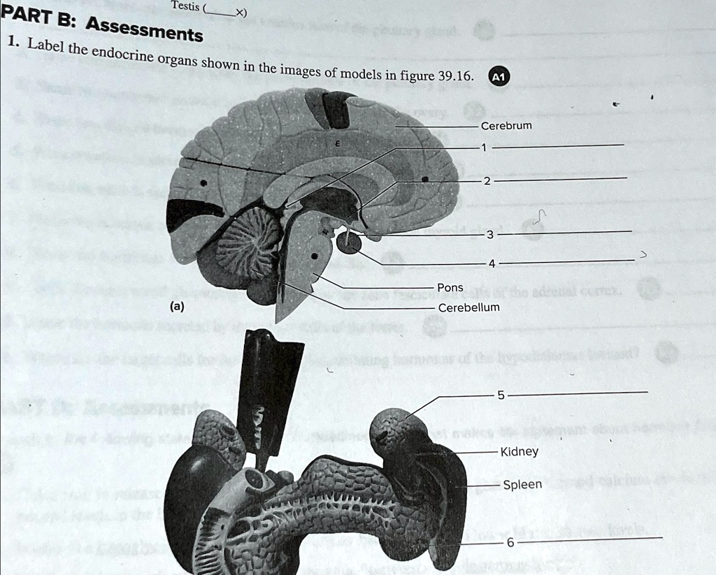 Testis ( X) PART B: Assessments 1. Label the endocrine organs shown in ...
