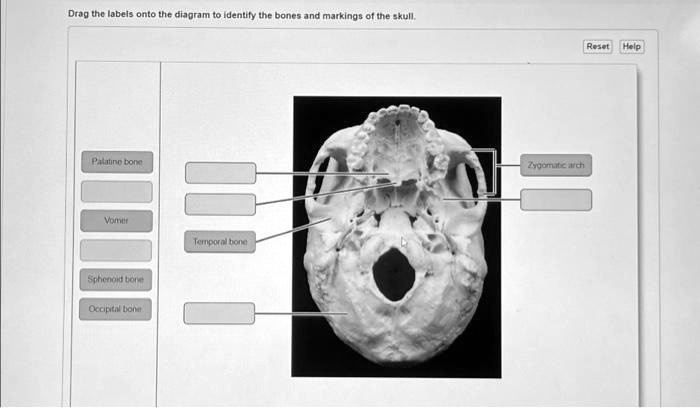Drag the labels onto the diagram to identify the bones and...