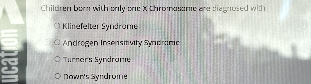 Children born with only one X Chromosome are diagnosed with Klinefelter ...