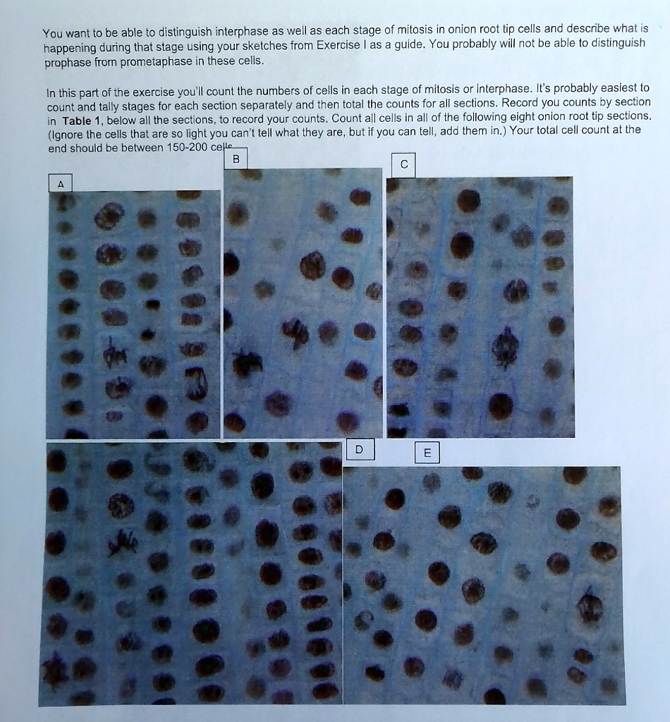 SOLVED: You want to be able to distinguish interphase as well as each stage of mitosis in onion ...