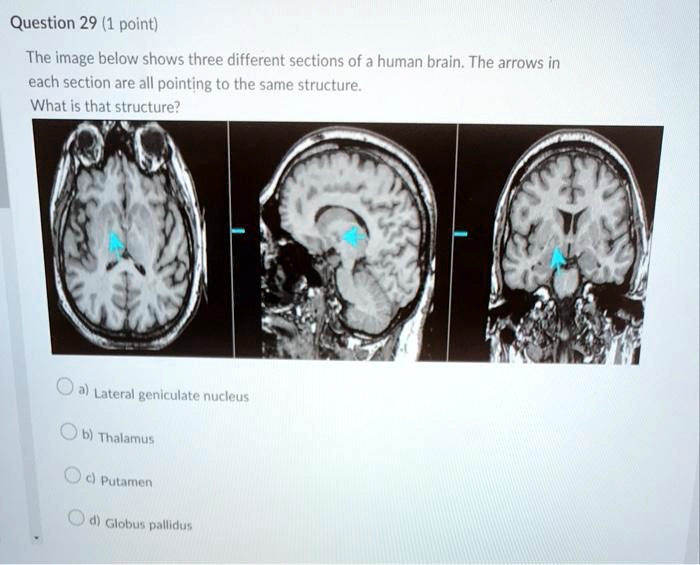 question 291 point the image below shows three different sections of a ...