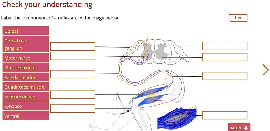 SOLVED: Check your understanding Label the components of a reflex arc in the image below. 1pt ...