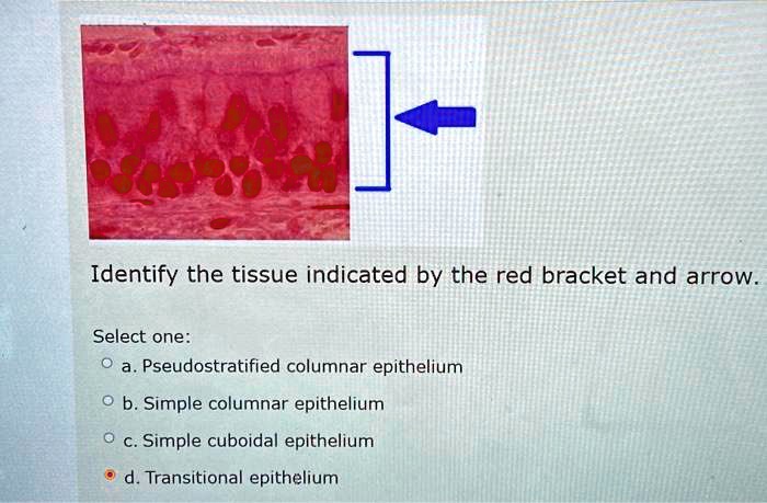 SOLVED: Identify the tissue indicated by the red bracket and arrow. Select one: a ...