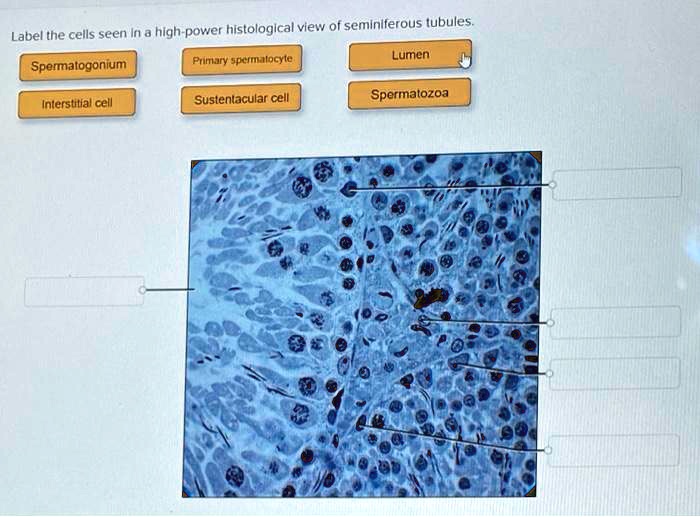 Label the cells seen in a high-power histological view of seminiferous ...