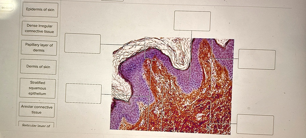Epidermis of skin Dense irregular connective tissue Papillary layer of ...