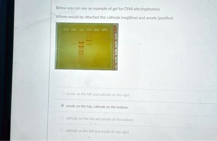 SOLVED: Below you can see an example of gel for DNA electrophoresis ...
