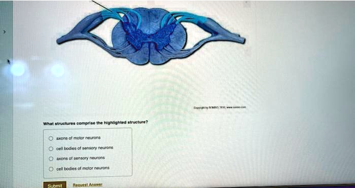 SOLVED: What structures comprise the highlighted structure Oaxons-ot ...