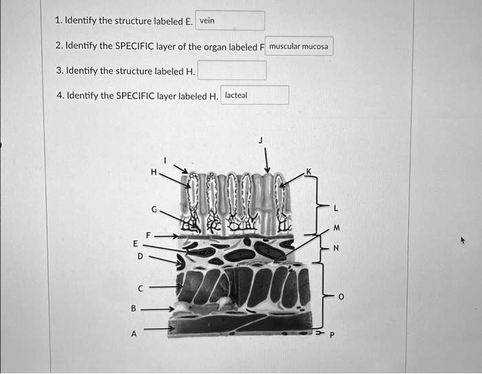 SOLVED: 1.Identify the structure labeled E. vein 2.Identify the SPECIFIC layer of the organ ...