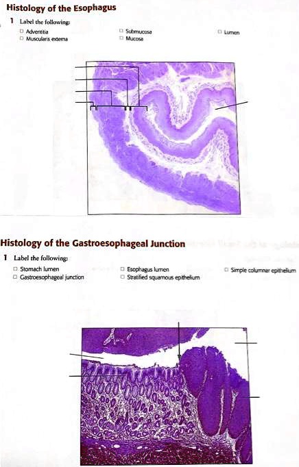 Histology of the Esophagus 1 Label the following: ? Adventitia ? Muscularis externa ? Submucosa ...
