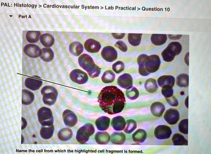 SOLVED: PAL: Histology > Cardiovascular System > Lab Practical ... SOLVED: PAL: Histology > Cardiovascular System > Lab Practical ...
