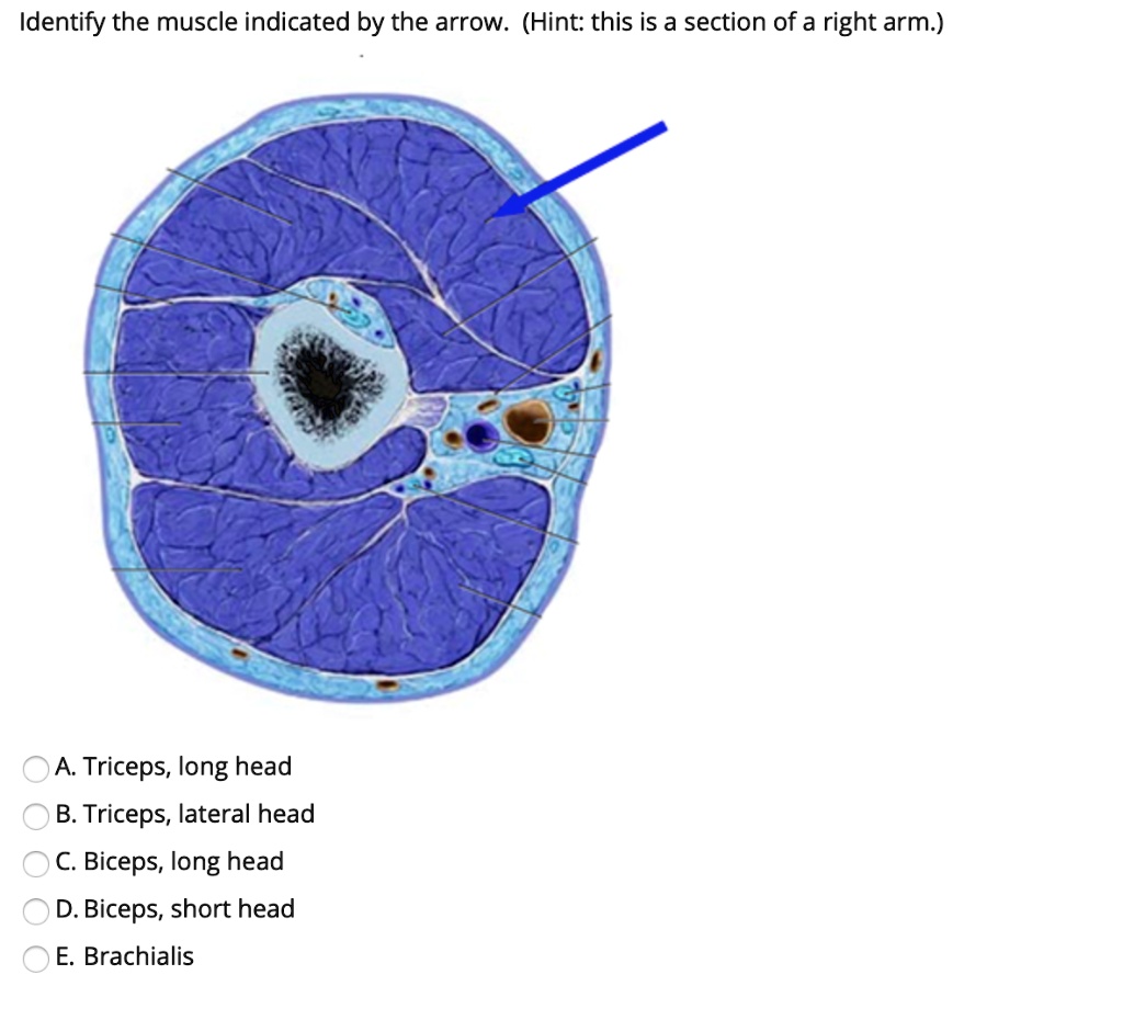 SOLVED: Identify the muscle indicated by the arrow: (Hint: this is a ...