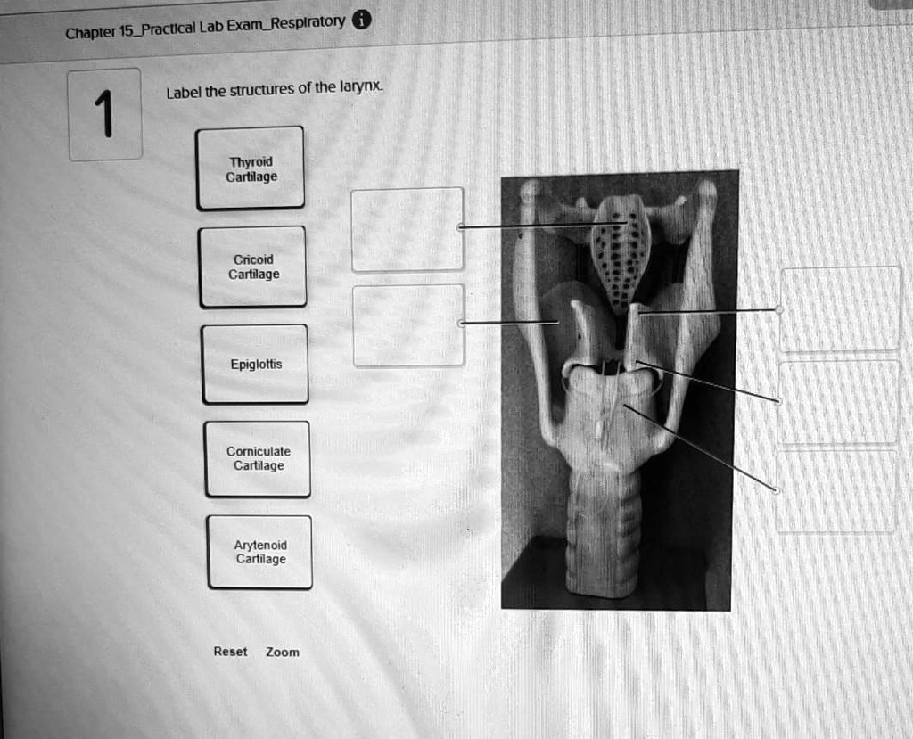 SOLVED: Chapter 15Practcal Lab ExamRespiratory Label the structures of the larynx 1 Thyroid ...