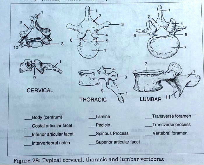 SOLVED: CERVICAL LUMBAR 11 THORACIC Body (centrum) Costal articular ...