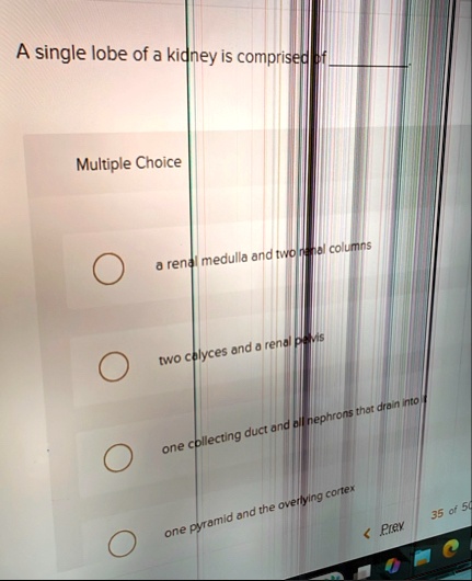 a single lobe of a kidney is comprised of multiple choice a renal ...