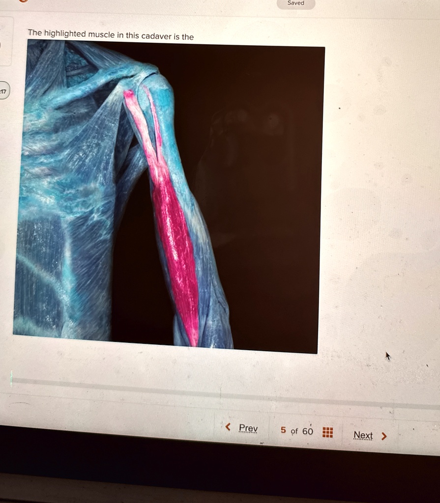 The highlighted muscle in this cadaver is the