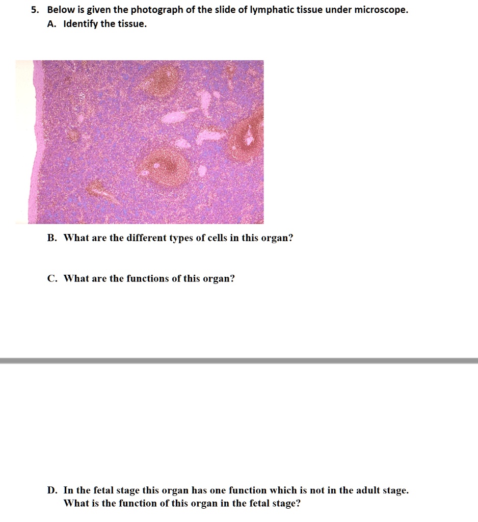 5. Below is given the photograph of the slide of lymphatic tissue under ...