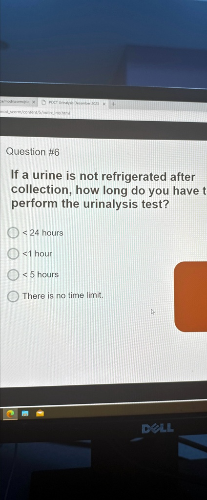 SOLVED: The correct answer is: Question #6 If a urine is not ...